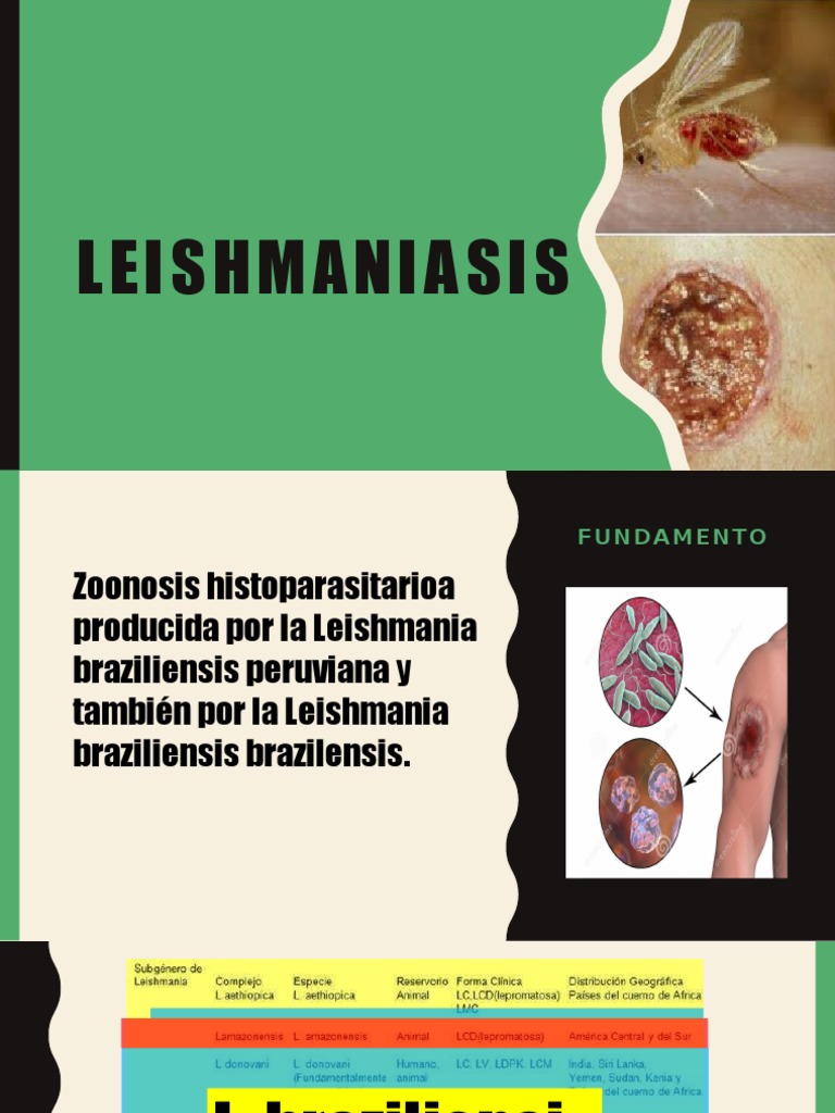 Leishmaniasis Diagnóstico Y Prevención Pdf Rtt Inmunología
