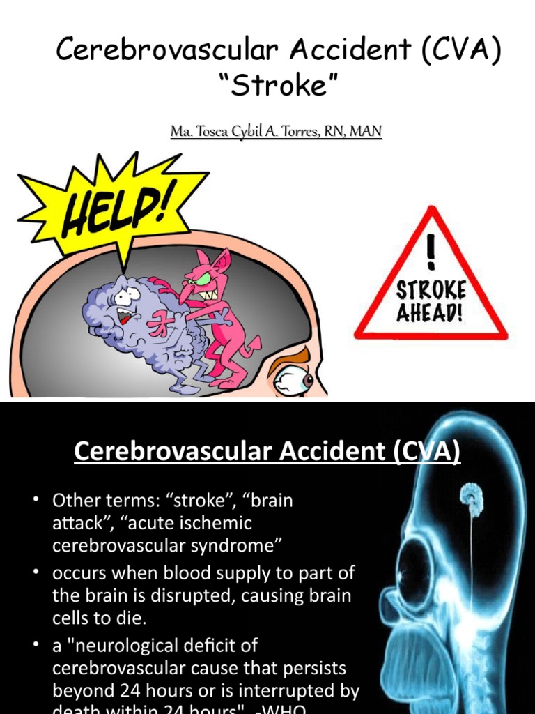 Cerebrovascular Accident (CVA) "Stroke": Ma. Tosca Cybil A. Torres, RN, MAN | PDF | Stroke ...