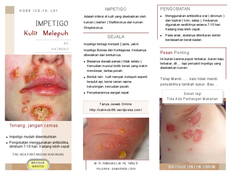 Impetigo | PDF
