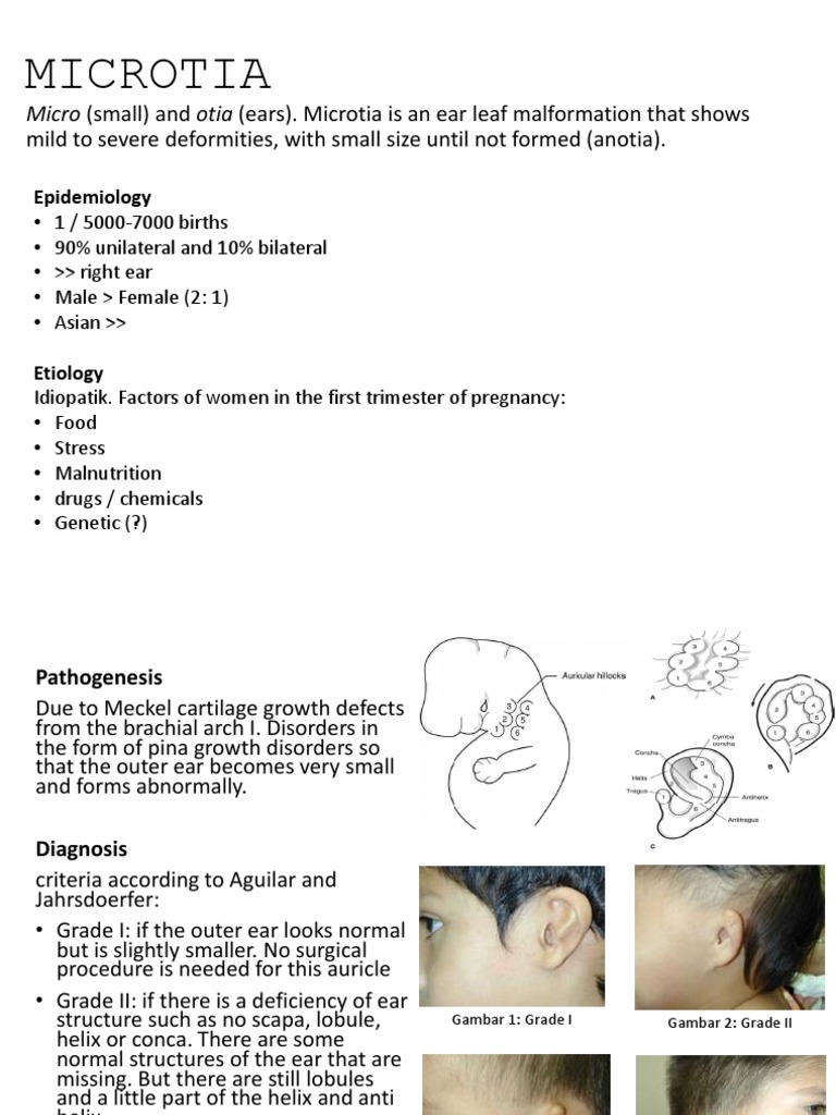 Understanding Microtia Grades and Management | PDF | Self-Improvement ...