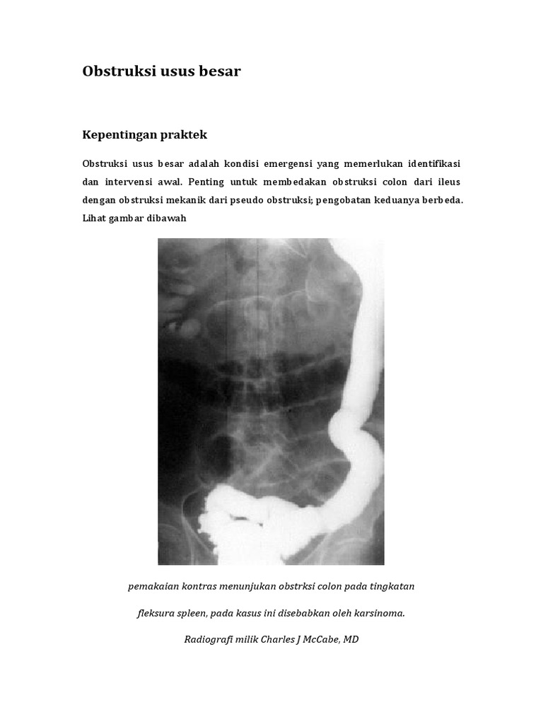 Obstruksi Usus Besar | PDF