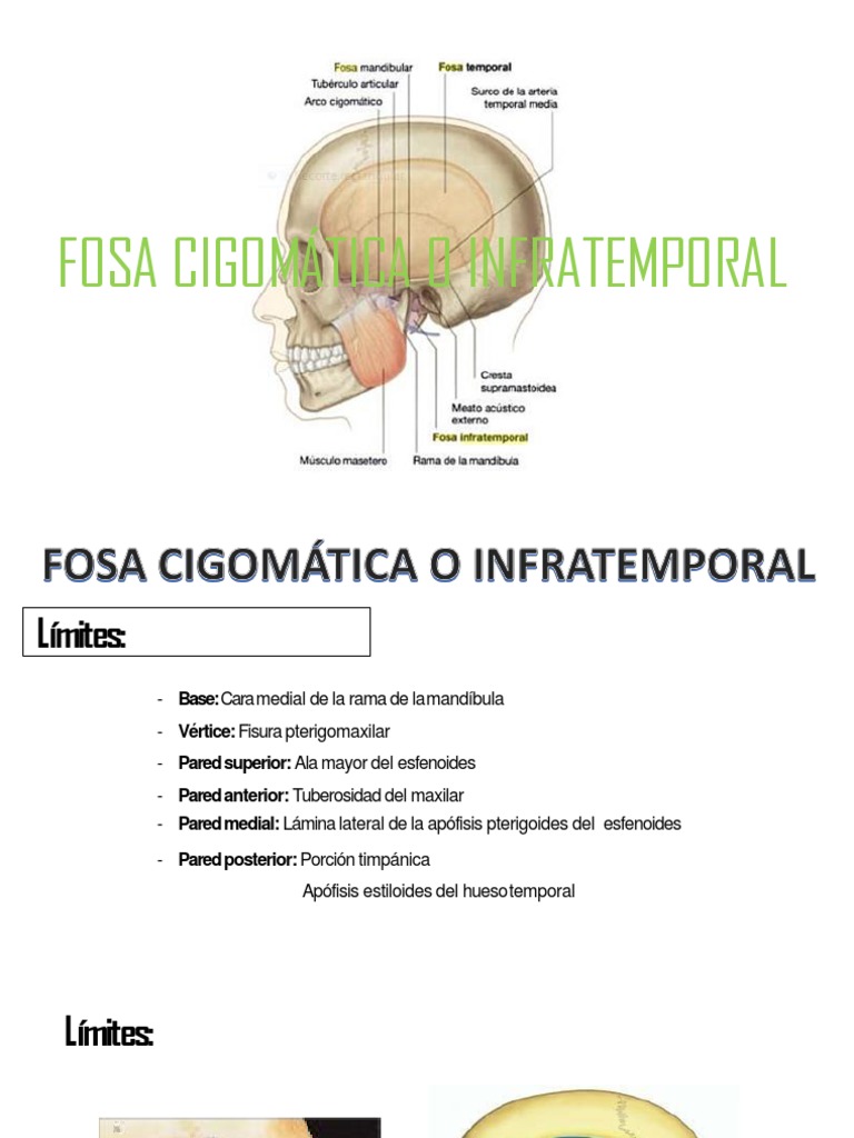 Anatomía de la Fosa Cigomática e Infratemporal | PDF