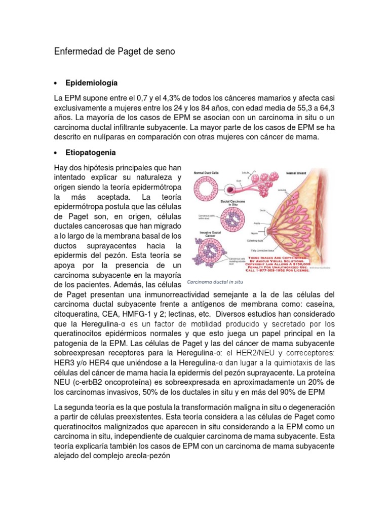 Enfermedad de Paget del pezón: diagnóstico y tratamiento | PDF | Cáncer ...