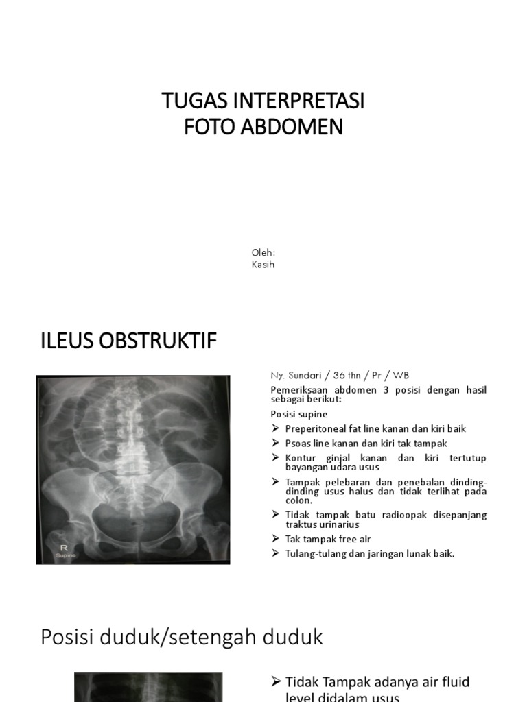 Radiologi Kelainan Abdomen | PDF