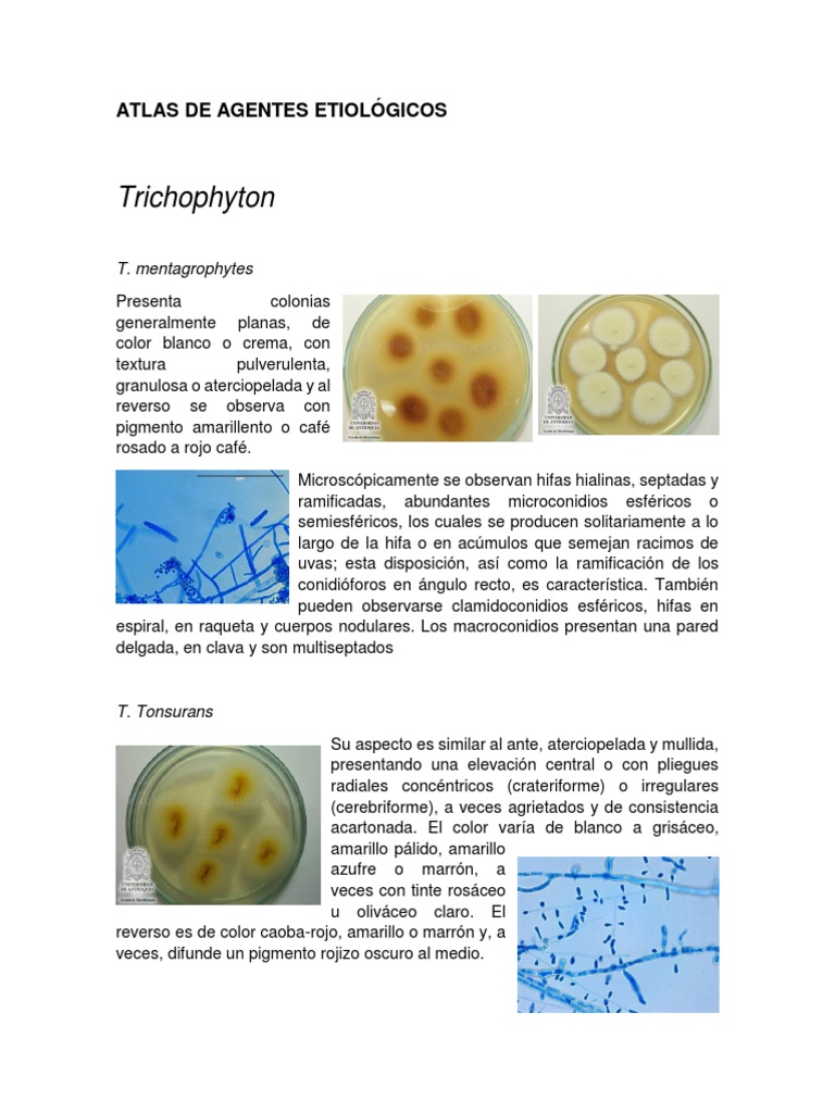 Atlas de Agentes Etiológicos | PDF | Hongo | Color