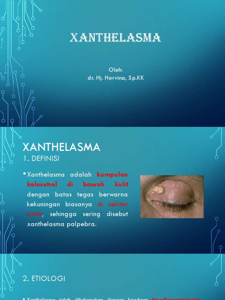 Xanthelasma Vs Xanthoma
