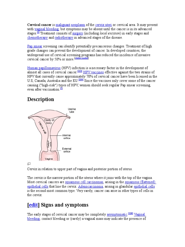 Description: Cervical Cancer Is | PDF | Cervical Cancer | Vagina