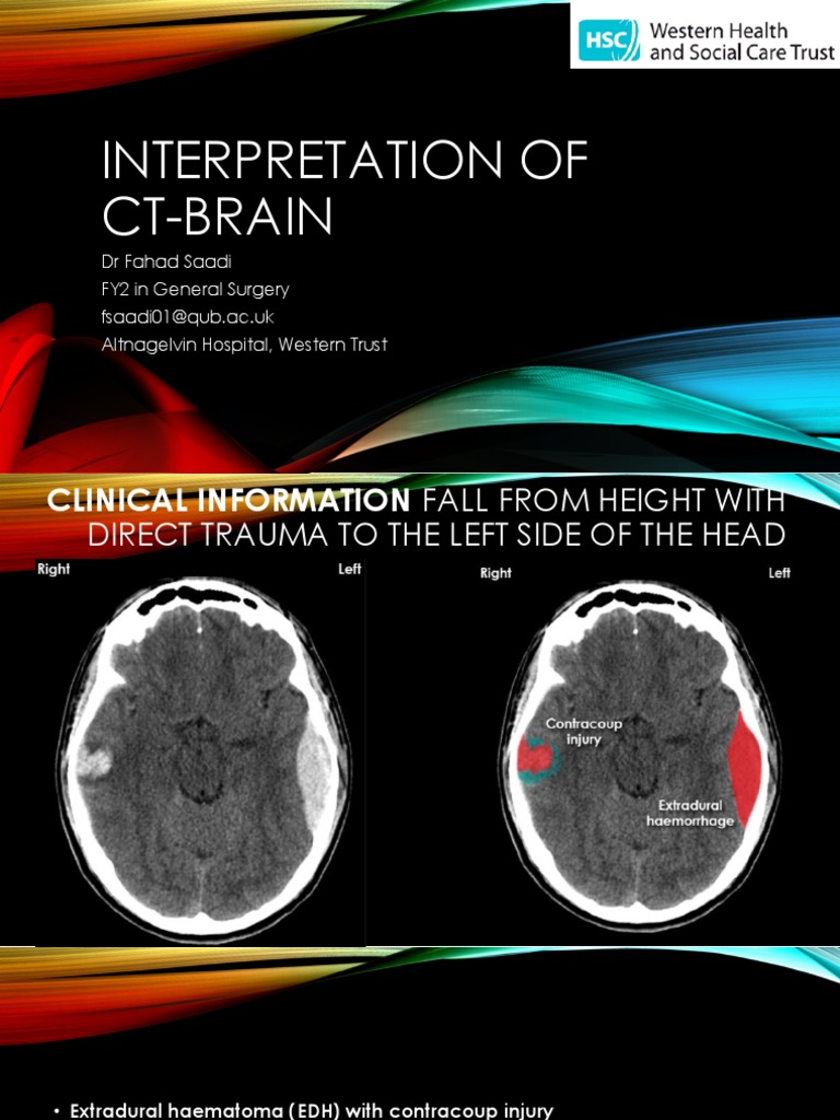 BT Brain Interpretation and Cases For Finals | PDF | Bleeding ...