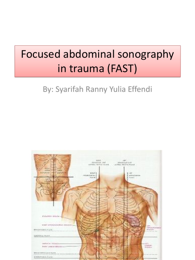 Focused Abdominal Sonography in Trauma (FAST) | Medical Ultrasound ...