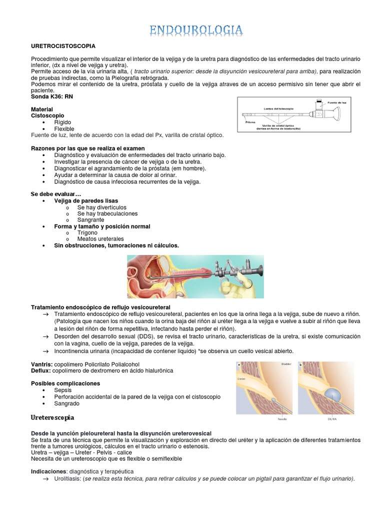 Endourologia | PDF | Vejiga urinaria | Sistema urinario