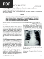 Centor Score (Modified - McIsaac) For Strep Pharyngitis - MDCalc | PDF ...