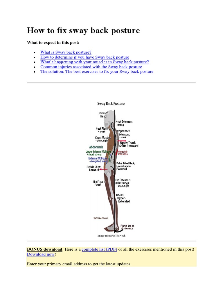 Swayback Posture