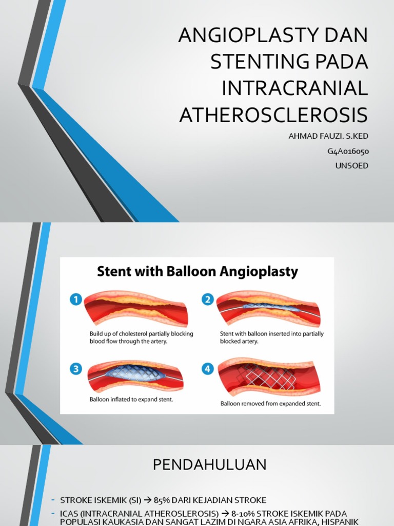 Angioplasty Dan Stenting Pada Intracranial Atherosclerosis | PDF