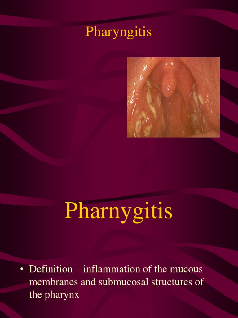 Pharyngitis 0104 Slides | PDF | Candidiasis | Streptococcus