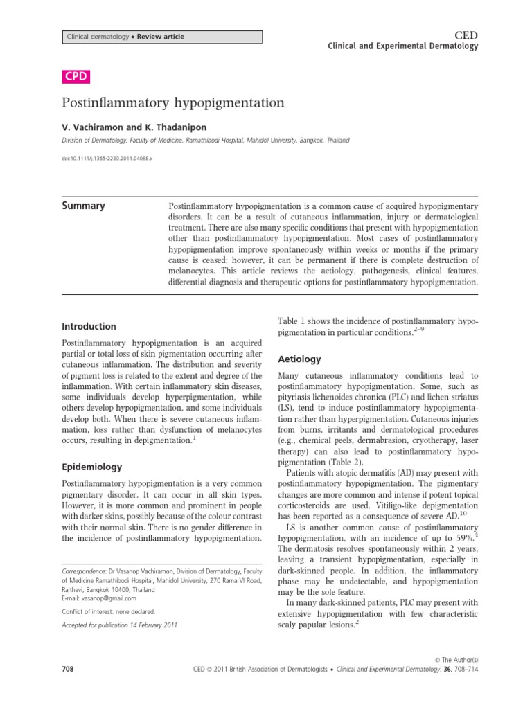 Postinflammatory Hypopigmentation: Clinical Dermatology - Review ...