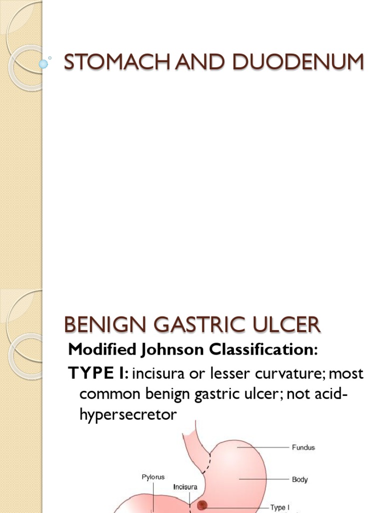 Classification and Management of Benign Gastric and Duodenal Ulcers ...