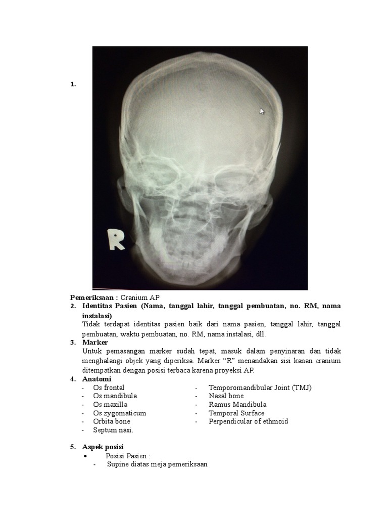 Pemeriksaan Cranium AP | PDF