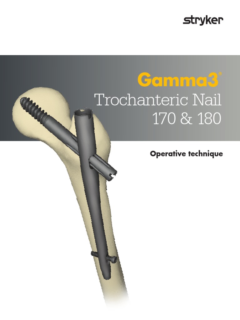 Trochanteric Nail 170 & 180: Gamma3 | PDF | Screw | Anatomical Terms Of ...