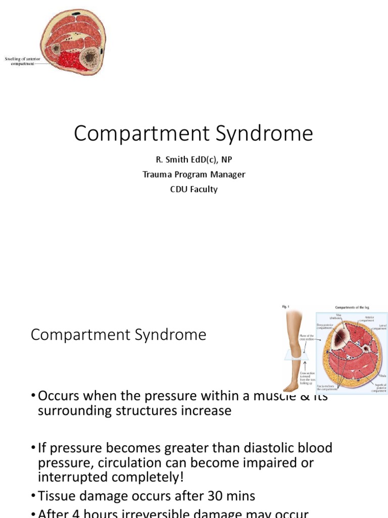 Compartment - Syndrome Rev 2017 | PDF | Clinical Medicine | Medicine