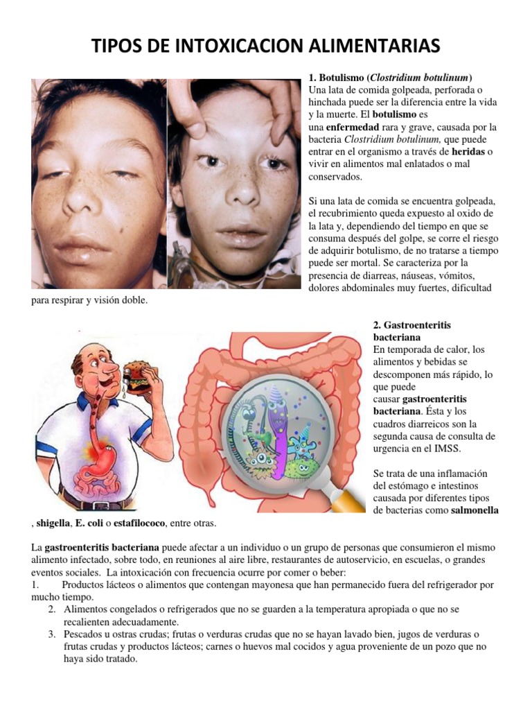 Tipos de Intoxicacion Alimentarias | PDF | Alimentos | Especialidades ...