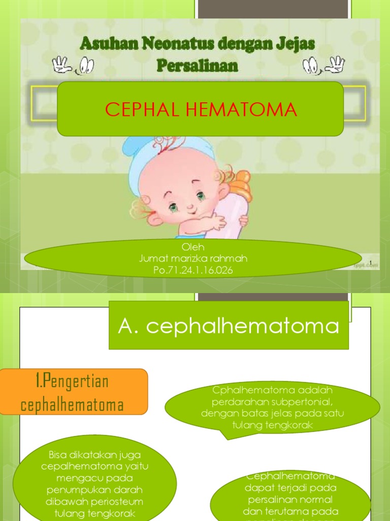 Cephal Hematoma | PDF