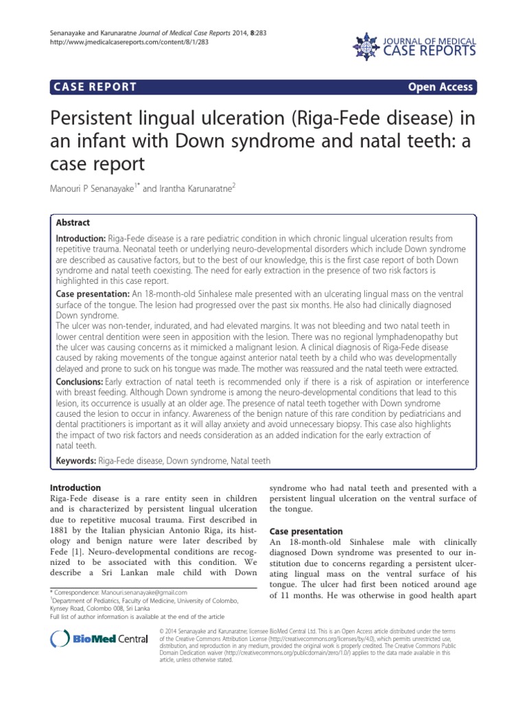 Persistent Lingual Ulceration (Riga-Fede Disease) in An Infant With ...
