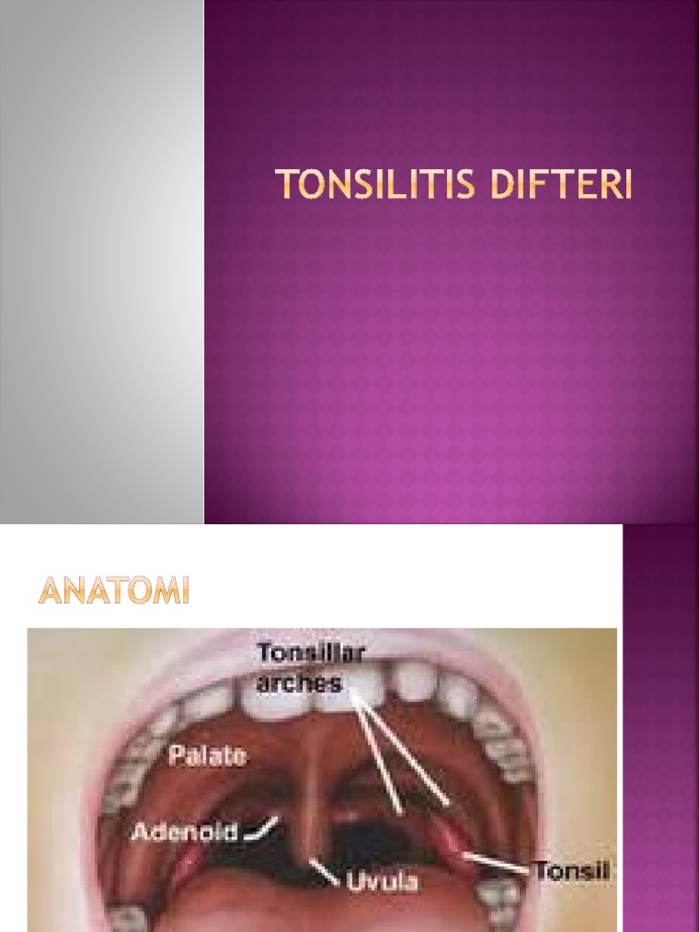 Tonsilitis Difteri | PDF