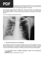 Anexo 3 Signo de Godet | PDF | Autosuperación | Bienestar