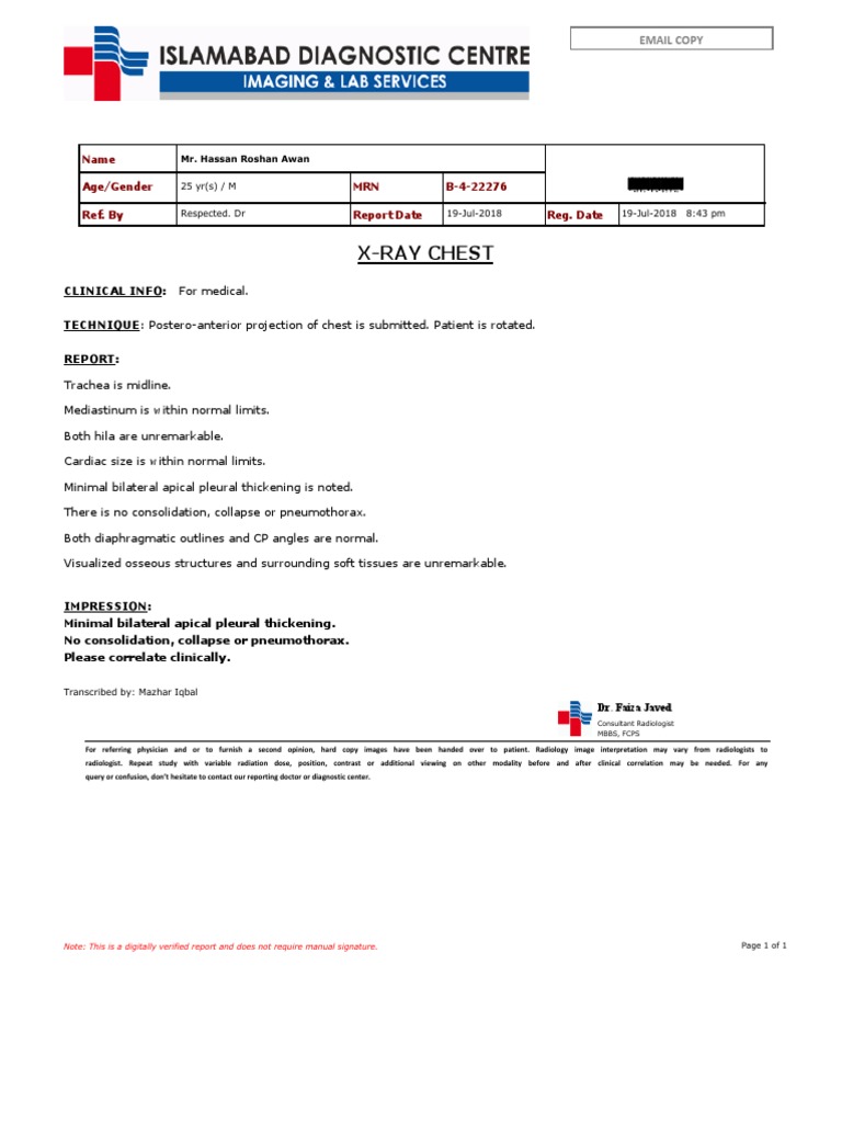 Normal Chest X-Ray PA View Report | PDF