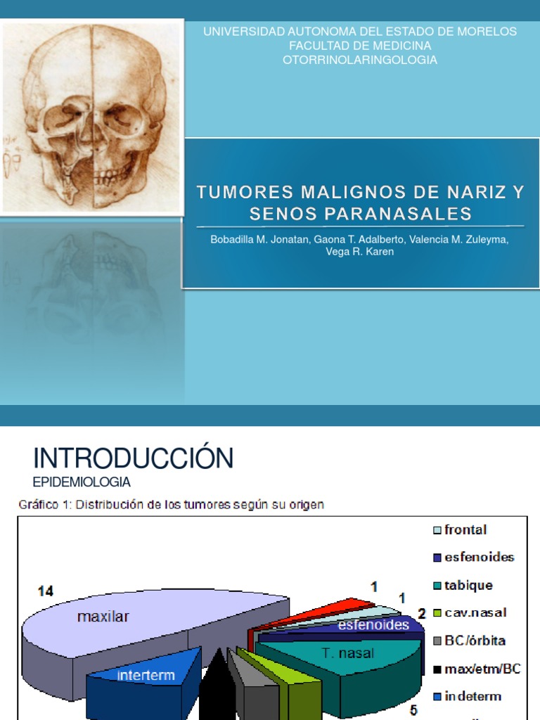 tumores-malignos-de-nariz.pptx | Cáncer | Anatomía