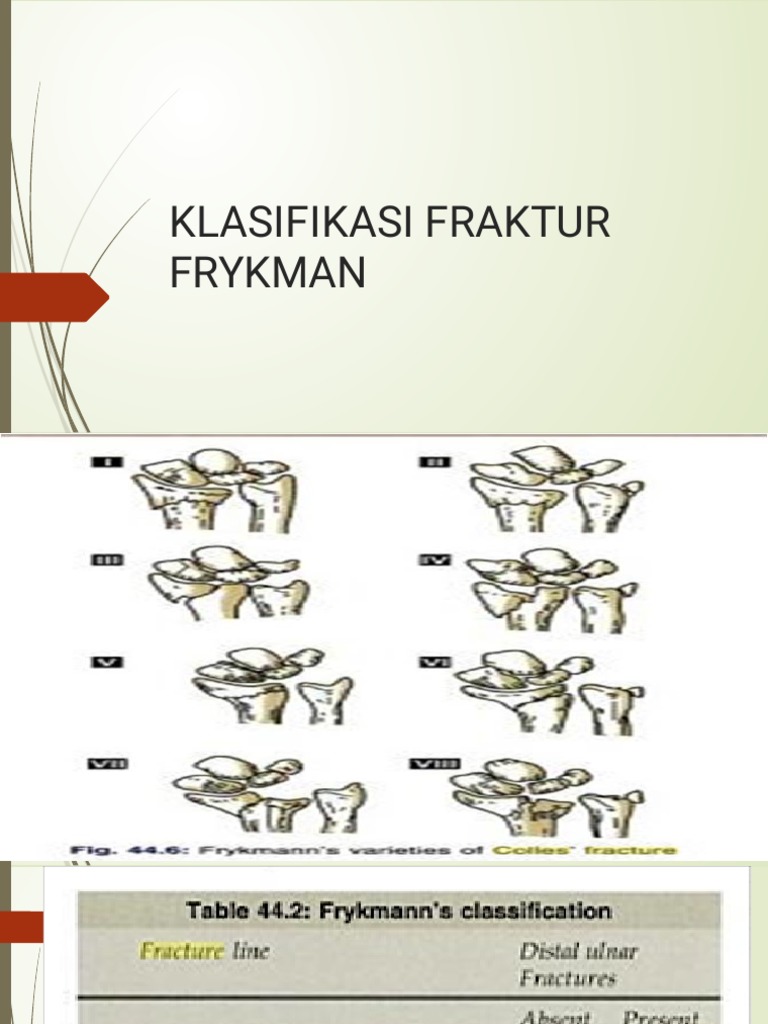 Klasifikasi Fraktur Frykman PDF | PDF