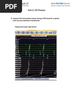 Manual - ST Jude Pacemaker PM2140 | PDF | Artificial Cardiac Pacemaker ...