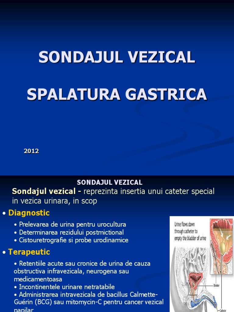 Sondaj Vezical | PDF