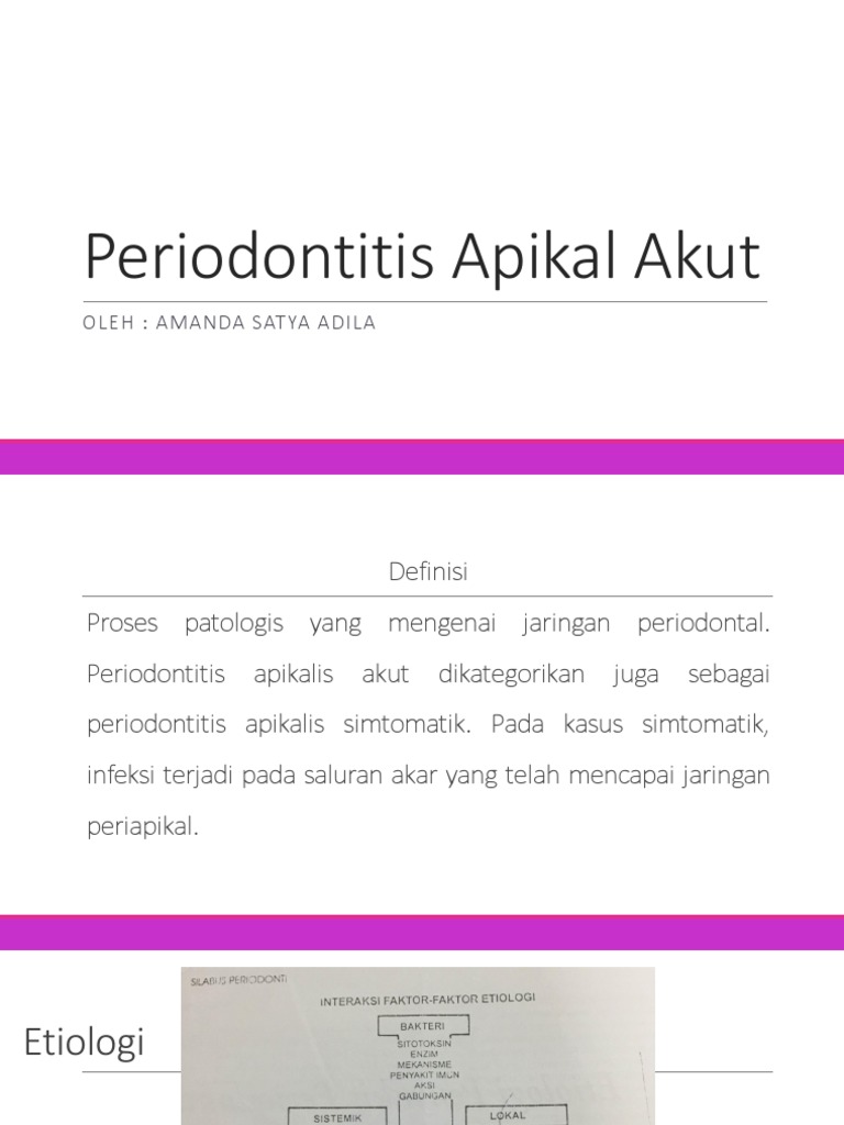 Periodontitis Apikal Akut | PDF