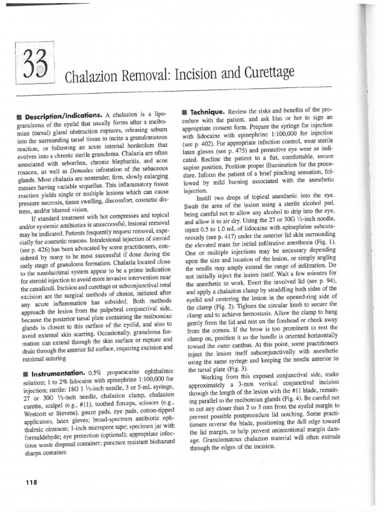 (5.06) Chalazion Removal - Incision and Curettage | PDF | Diseases Of ...