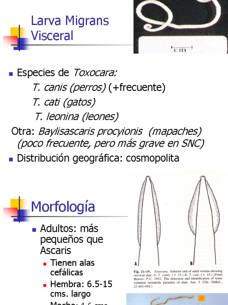 Larva Migrans Visceral