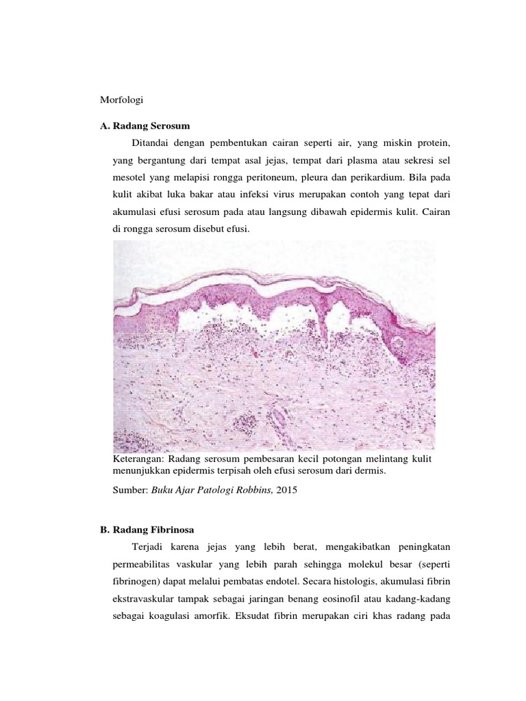 Morfologi Inflamasi | PDF