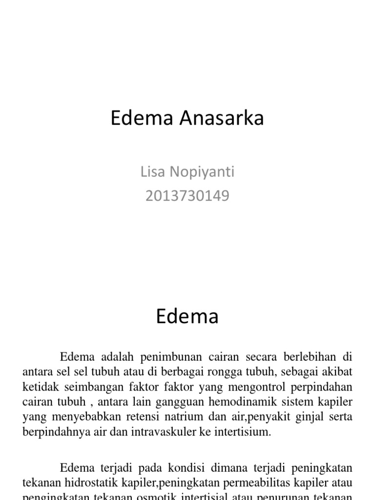Edema Anasarca | PDF