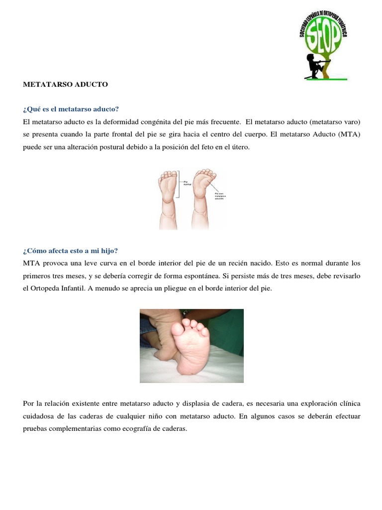 13 Metatarso Aducto | PDF