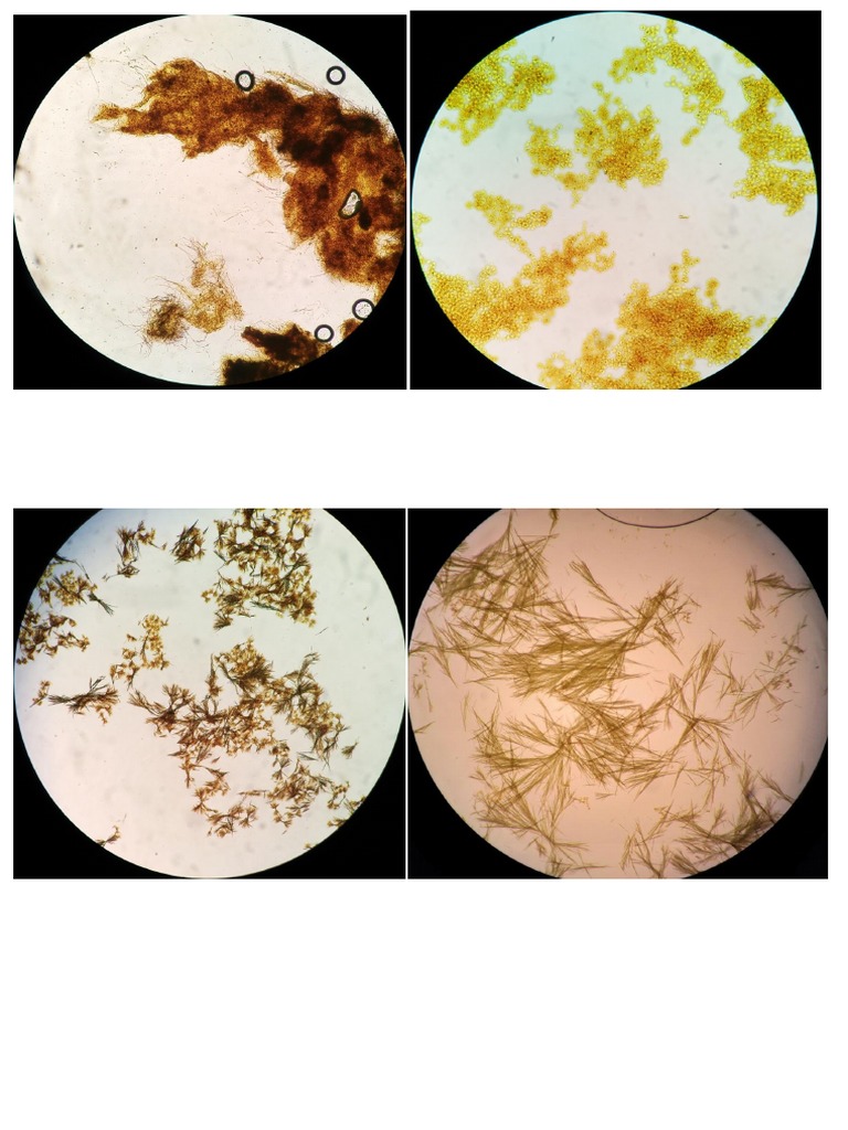 Kristal Osazon | PDF