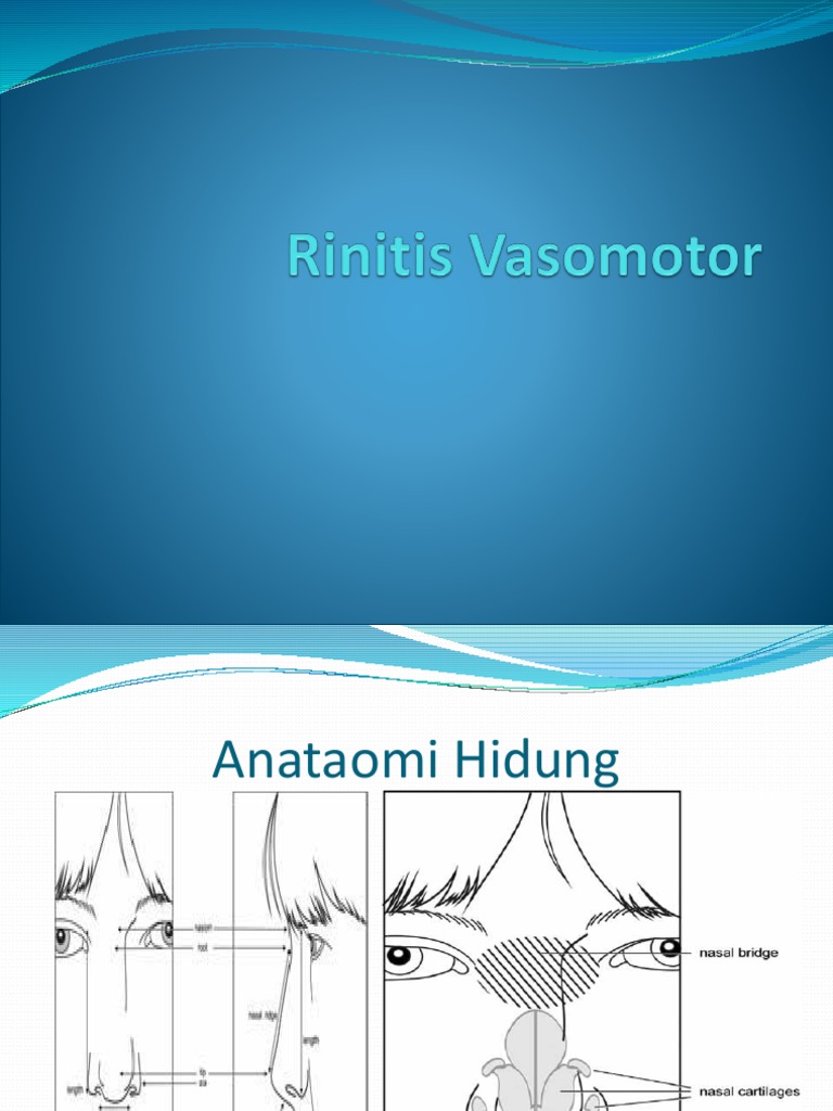 Rhinitis Vasomotor | PDF
