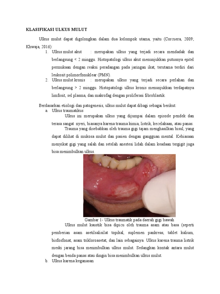 Klasifikasi Ulkus Mulut | PDF | Kesehatan Holistik | Sains & Matematika