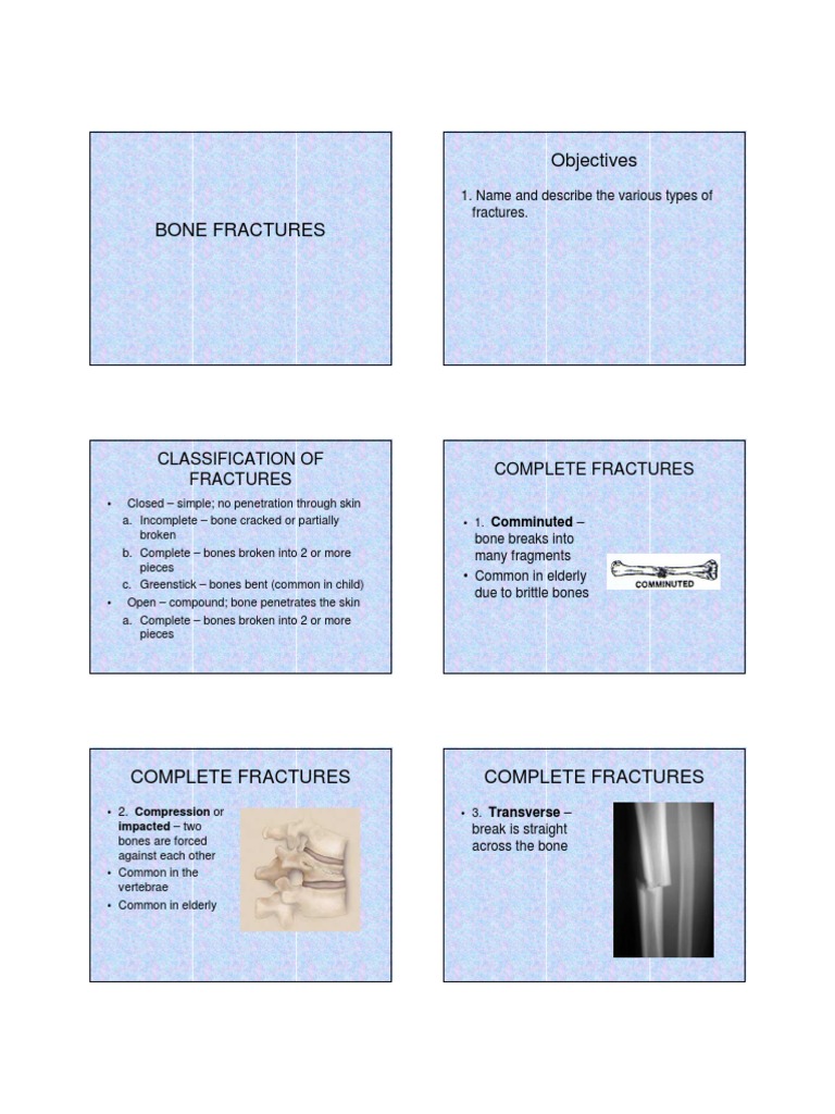 Objectives: Classification of Fractures Complete Fractures | PDF | Bone ...