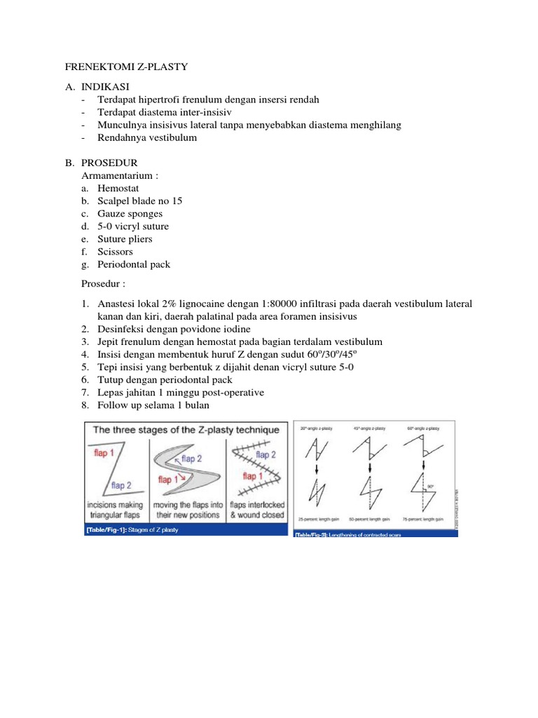 Frenektomi Z Plasty | PDF