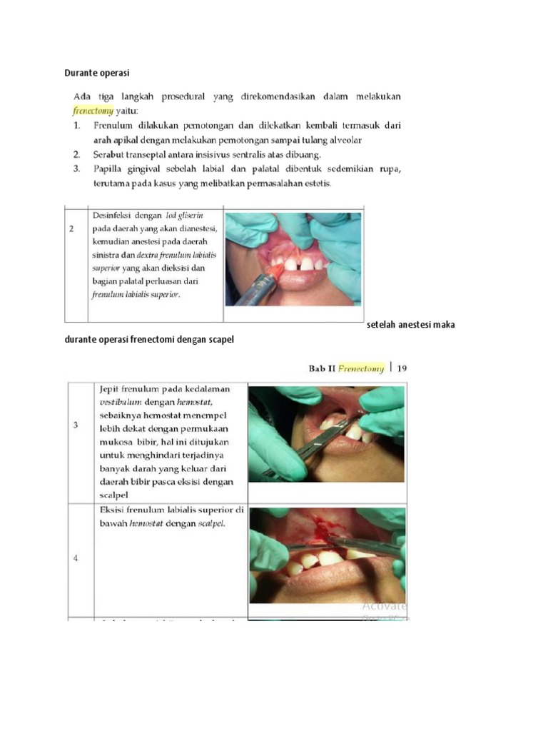 Durante Operasi | PDF | Pengembangan Diri | Kesehatan Holistik