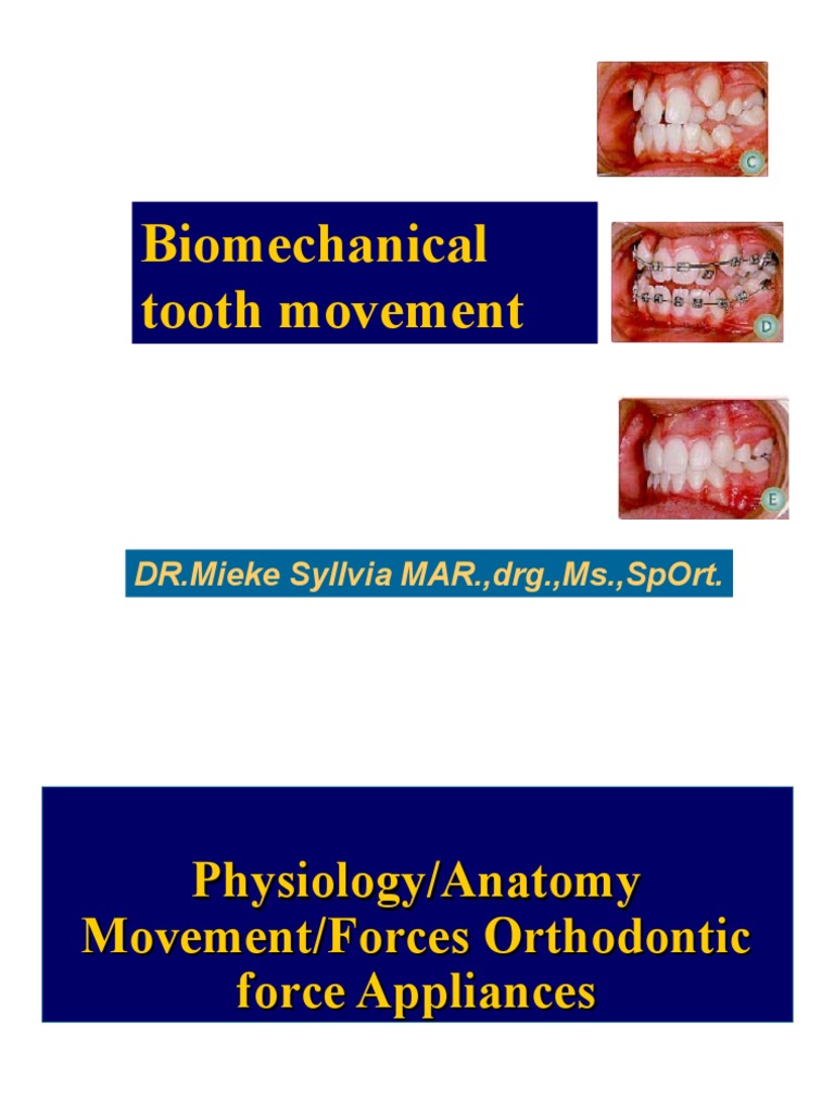 Biomechanical Tooth Movement: DR - Mieke Syllvia Mar.,Drg.,Ms.,Sport ...