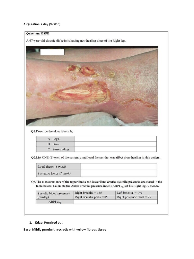 Diabetic Leg Ulcer ABPI Assessment | PDF