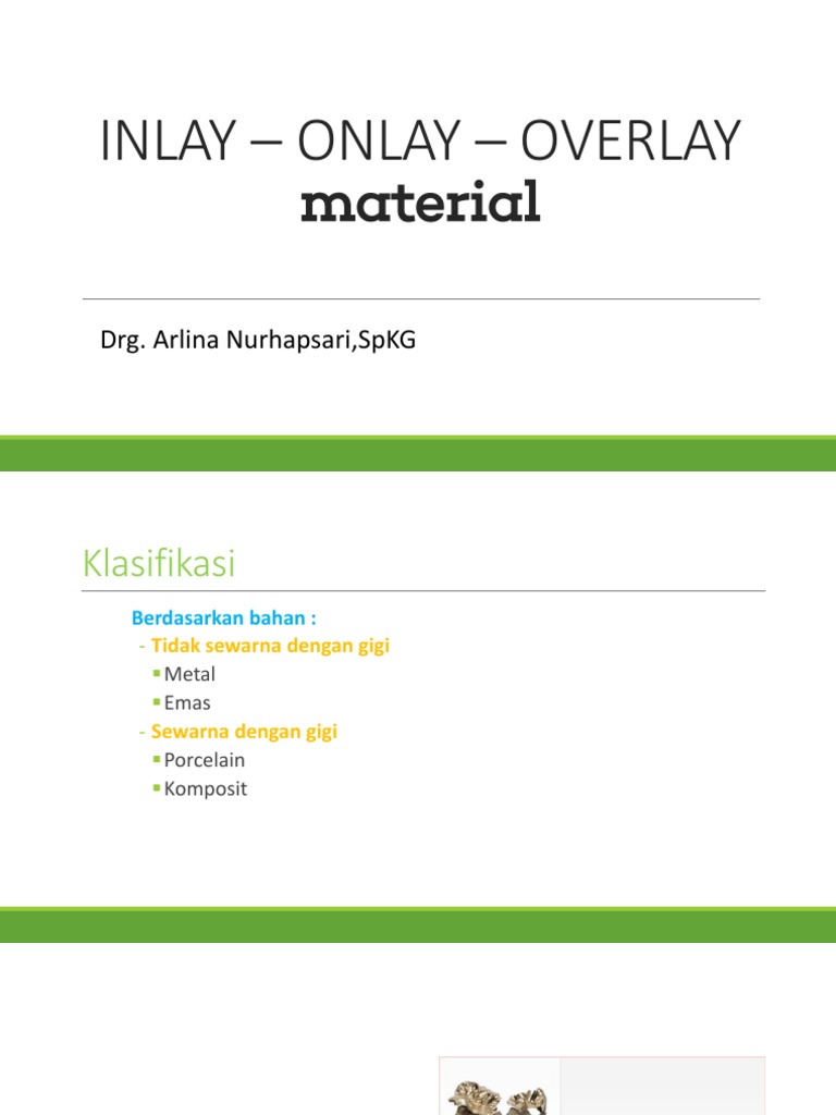 Inlay Onlay | PDF