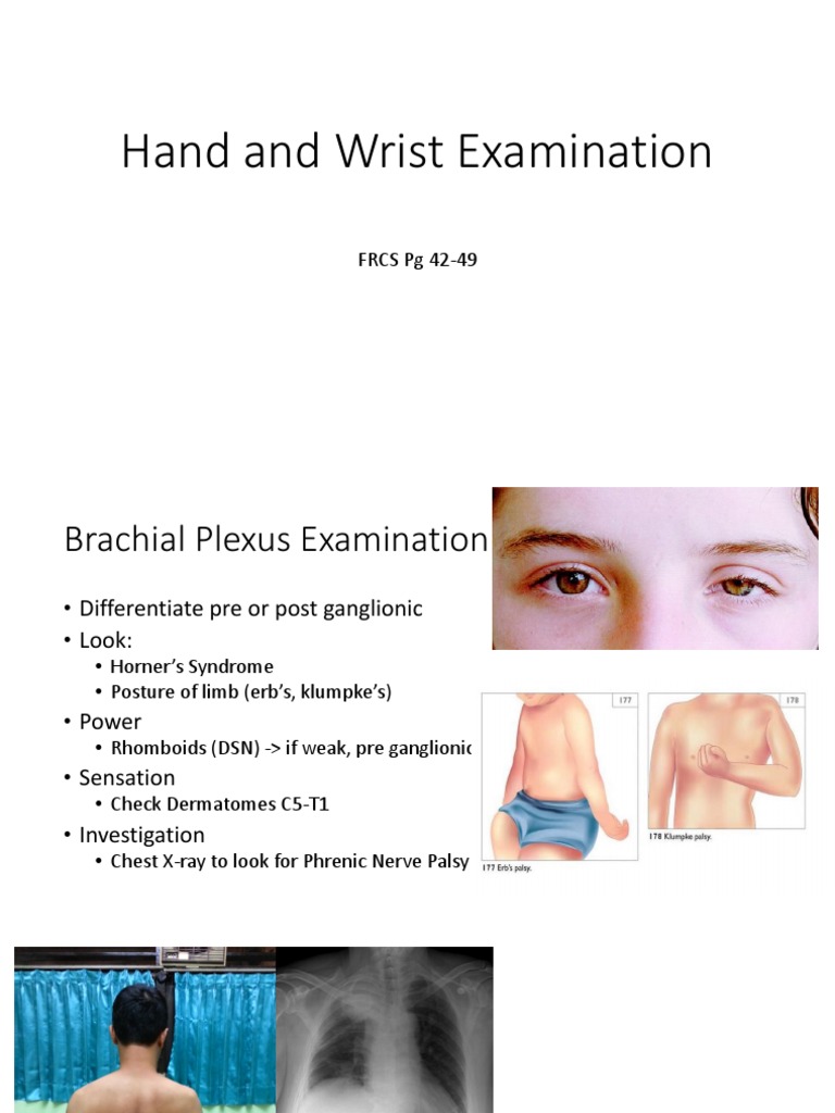 Hand and Wrist Examination Guide | PDF | Elbow | Thumb