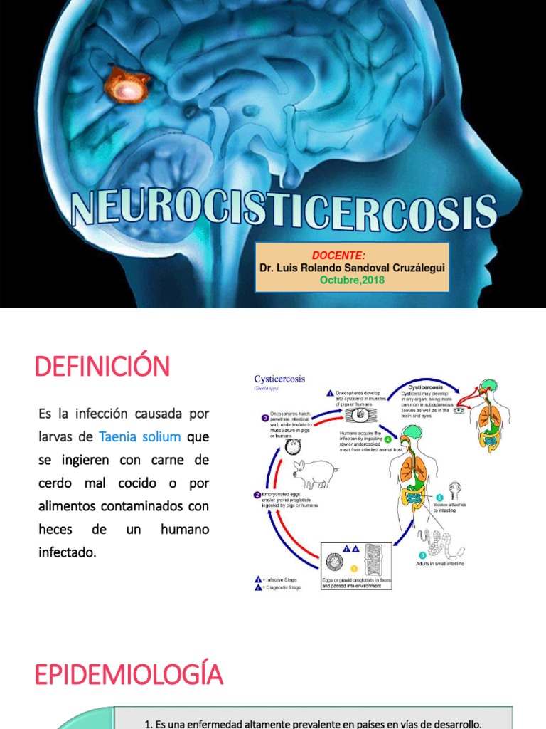 06 Clase - Neurocisticercosis | PDF | Epilepsia | Especialidades Medicas